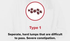 The Bristol Stool Chart: Is your stool healthy? | Ultimate Performance Blog